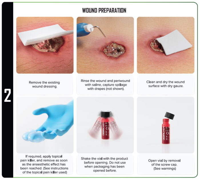 DEBRICHEM® INNOVATING THE FUTURE OF WOUND CARE - Innovating The Future ...