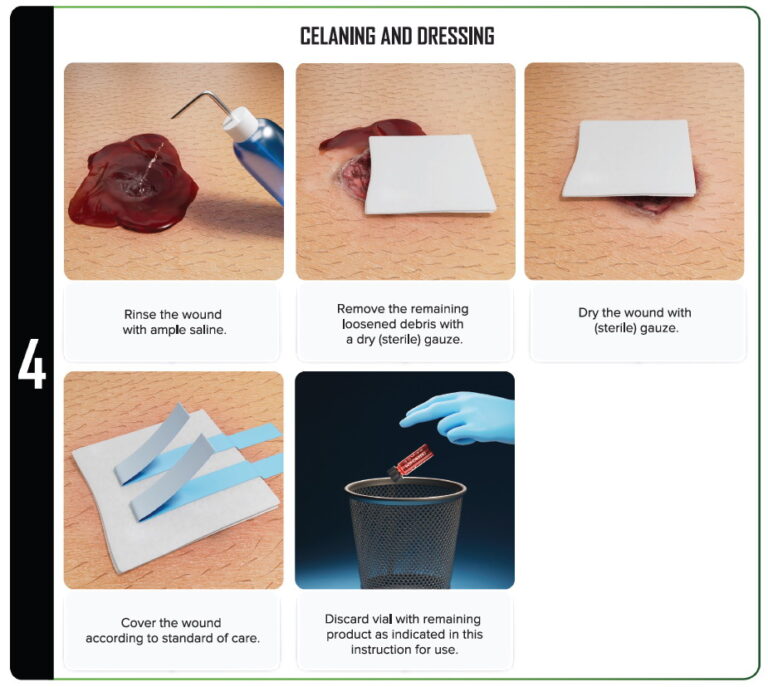 DEBRICHEM® INNOVATING THE FUTURE OF WOUND CARE - Innovating The Future ...