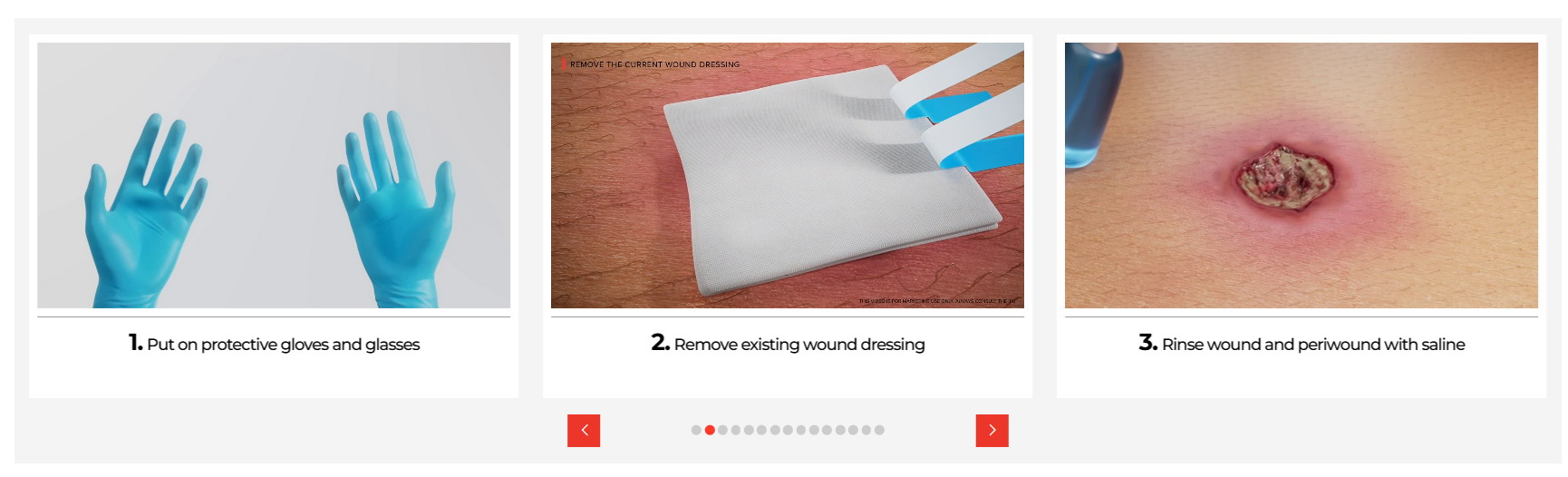 DEBRICHEM® INNOVATING THE FUTURE OF WOUND CARE - Innovating The Future ...