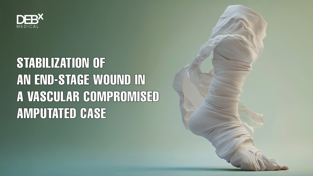 Stabilization of an End-Stage Wound in a Vascular Compromised Amputated ...